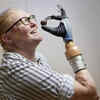 World's First 'Real Bionic Woman' Equipped With Controllable Artificial ...