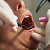 Explained: World Oral Health Day: 10 Common And Disproven Dental Health ...