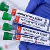 First Suspected Case Of Monkeypox Reported From Kerala In A Passenger ...