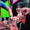 Mumbai measles cases traced to missed vaccines