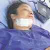 Hit by stone, woman breaks jaw