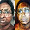 Woman loses face to facial