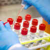 Private labs ask Centre to help them provide free tests